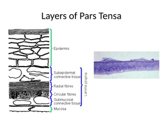 Chronic Suppurative Otitis Media - Tubo-Tympanic type | PPTX