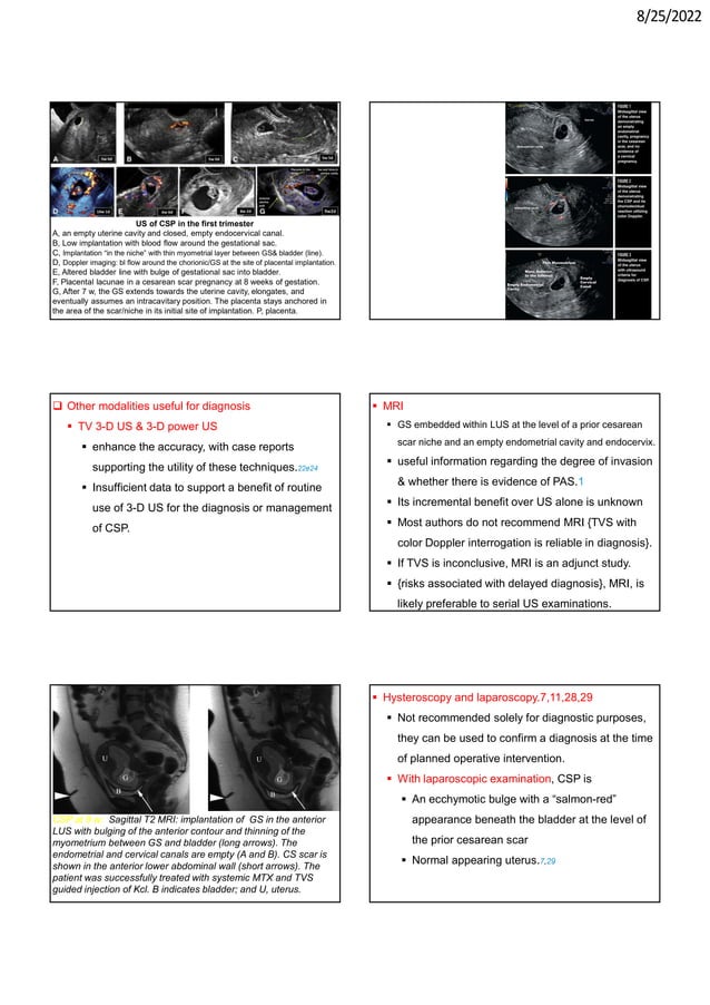 CSP ACOG2021.pdf