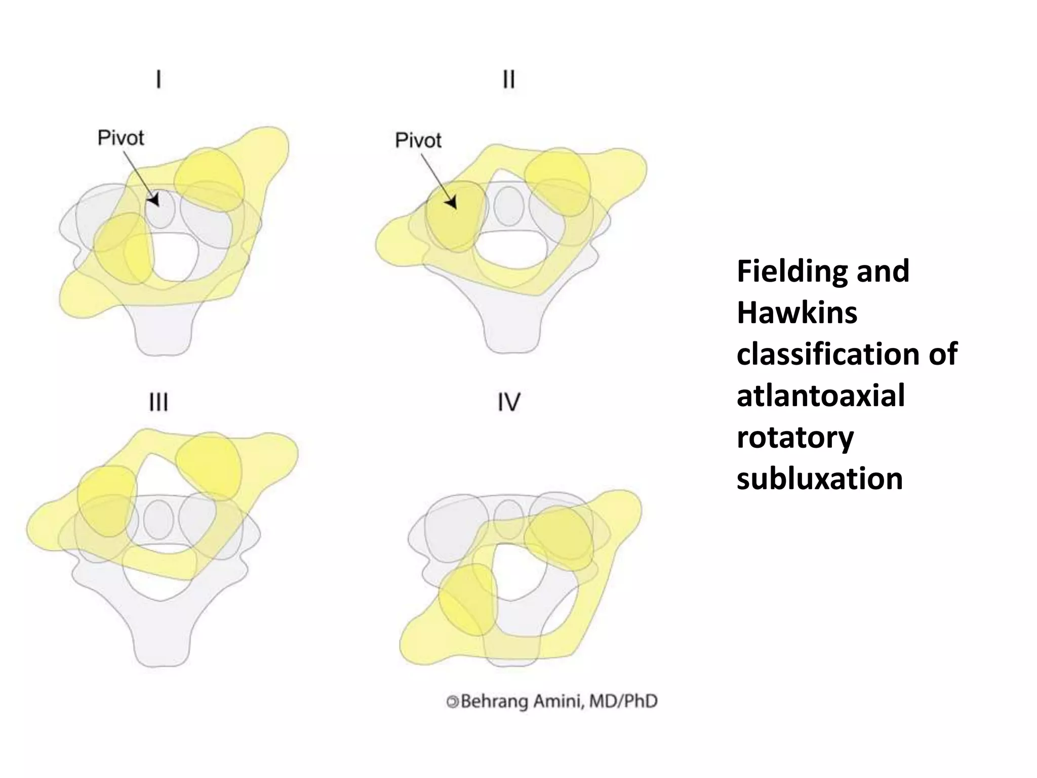 CT Cervical Spine | PPTX