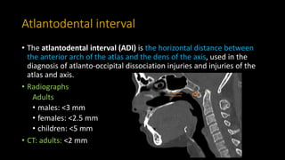 Cervical spine injuries | PPTX