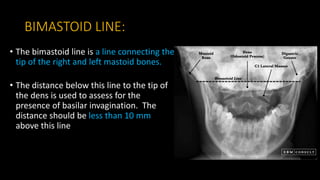 Cervical spine injuries | PPTX