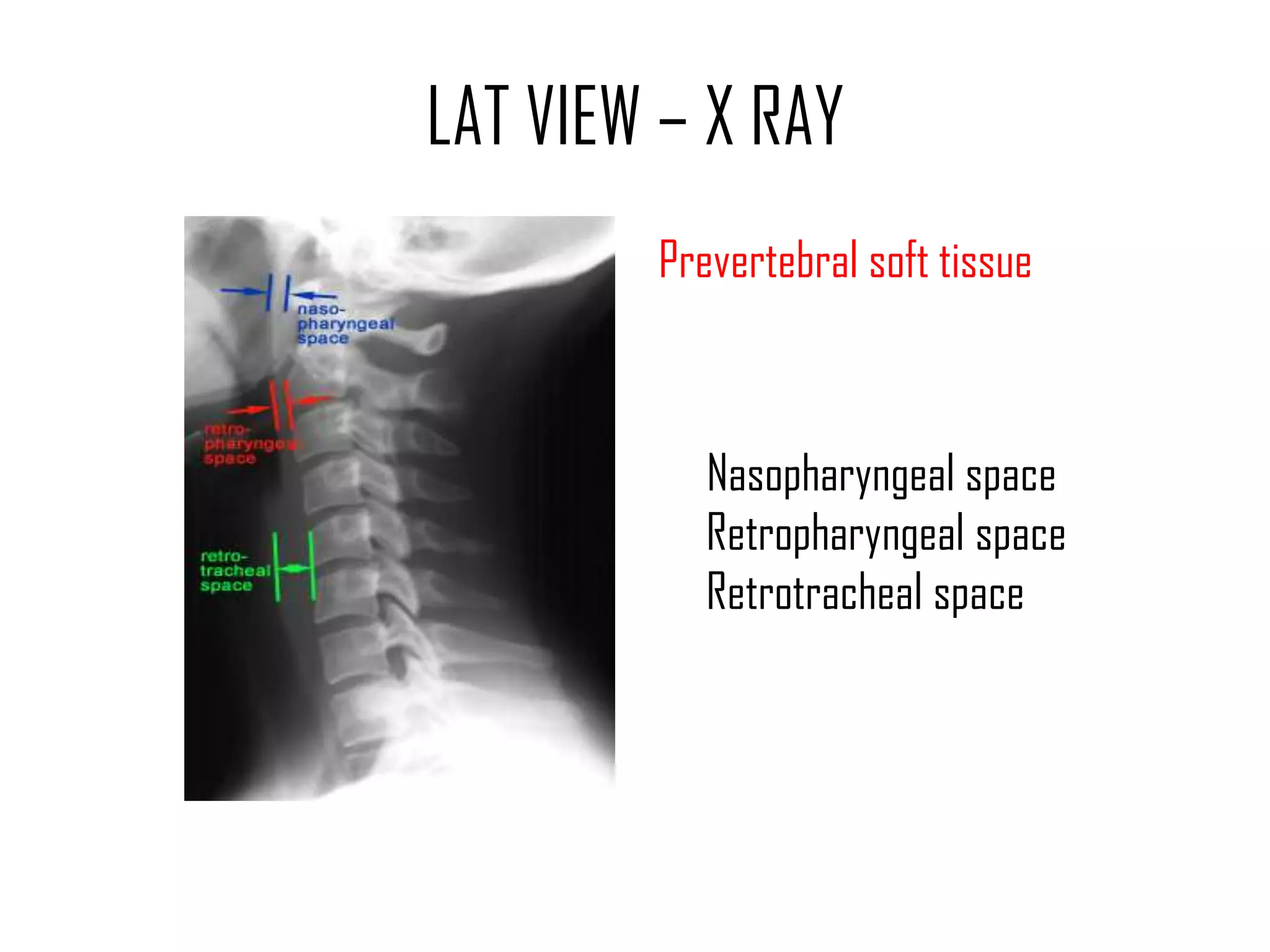 Cervical Fractures and Cervical spine injuries - Dr.KK