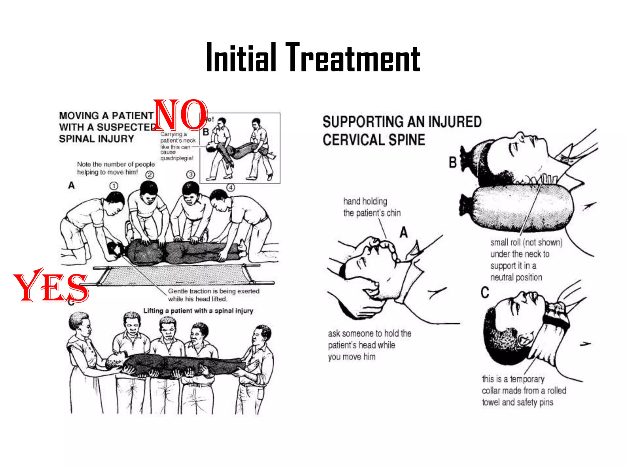 Cervical Fractures and Cervical spine injuries - Dr.KK