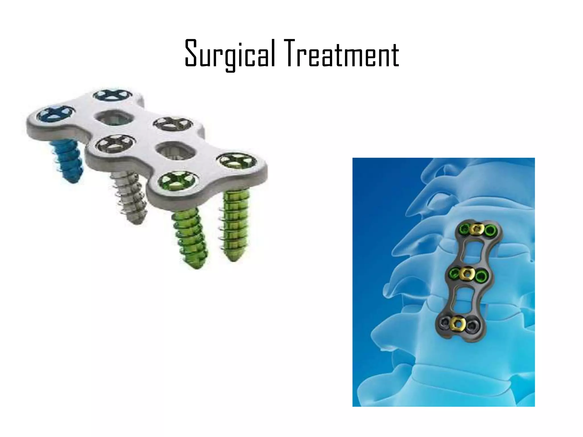 Cervical Fractures and Cervical spine injuries - Dr.KK