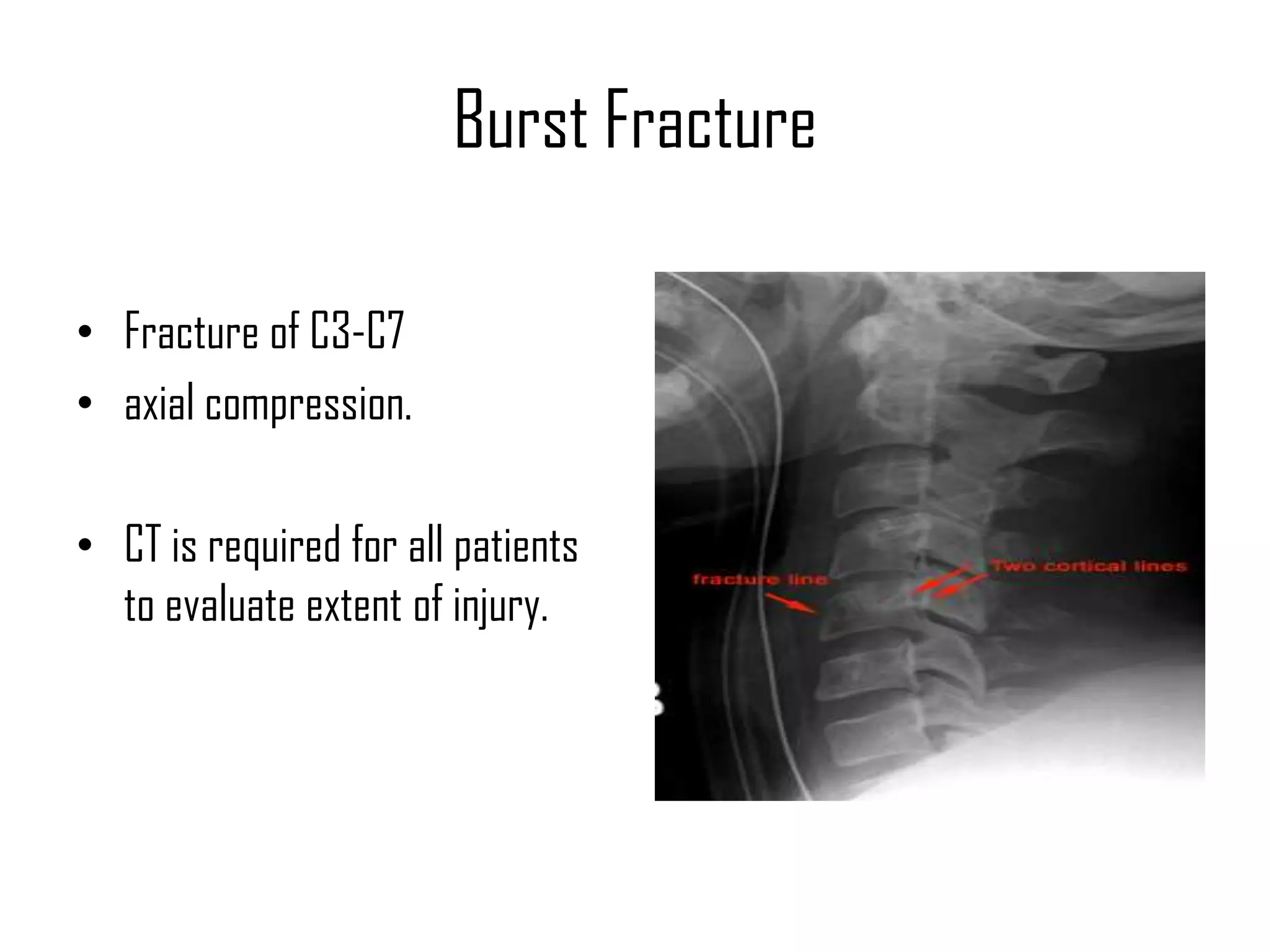 Cervical Fractures and Cervical spine injuries - Dr.KK