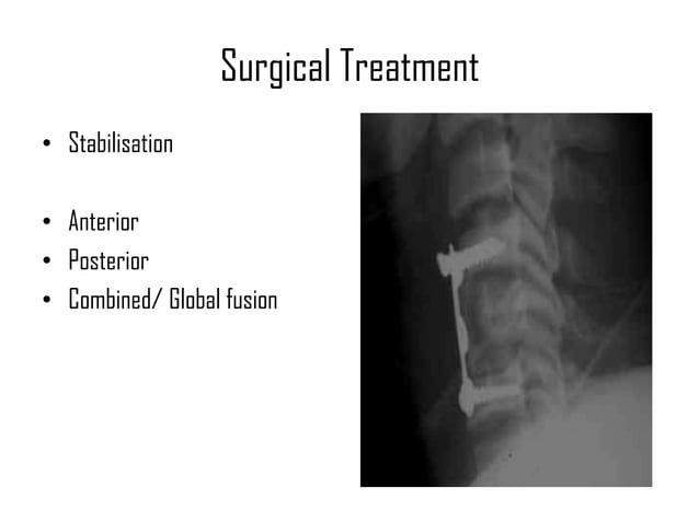 Cervical Fractures and Cervical spine injuries - Dr.KK