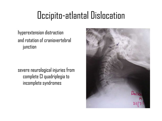Cervical Fractures and Cervical spine injuries - Dr.KK
