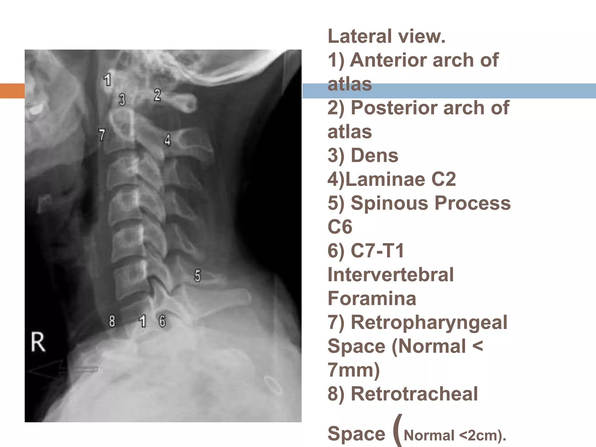 C spine positioning | PPTX