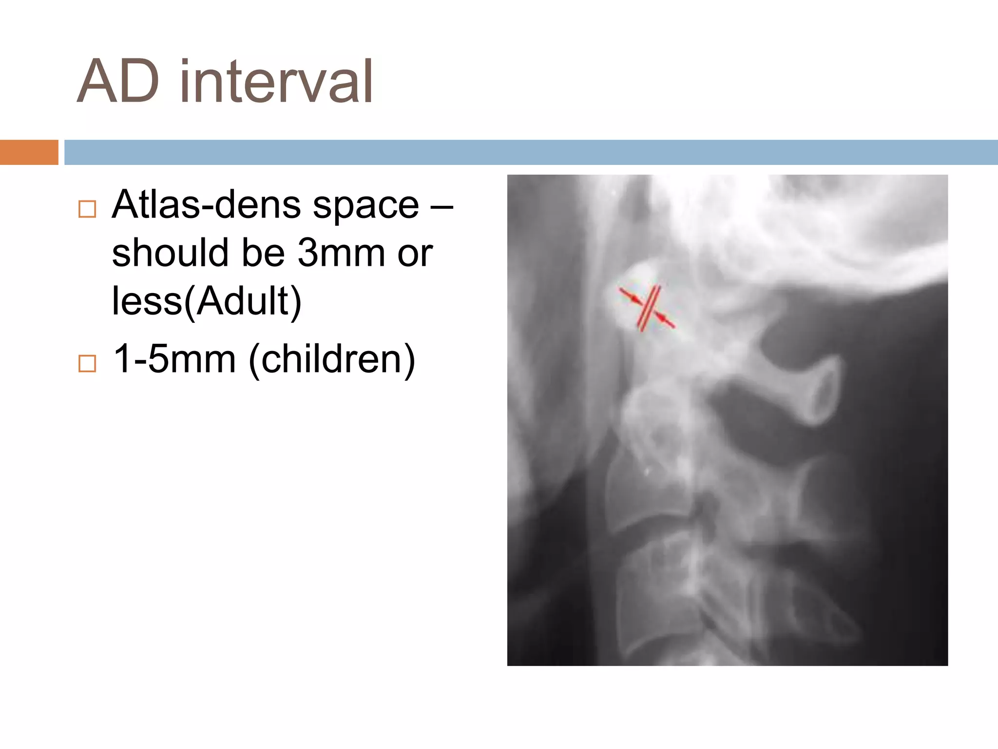 C spine positioning | PPTX