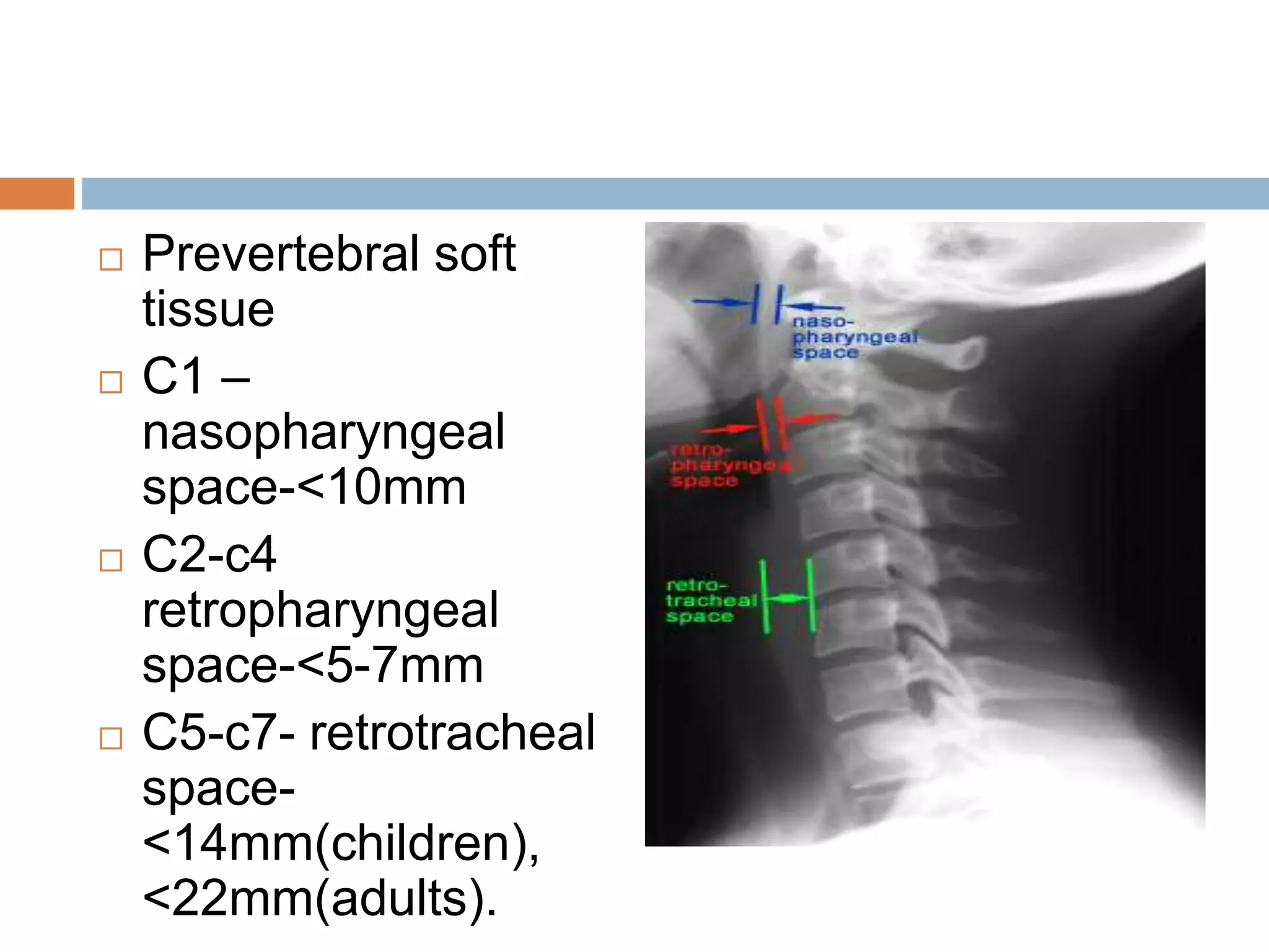 C spine positioning | PPTX
