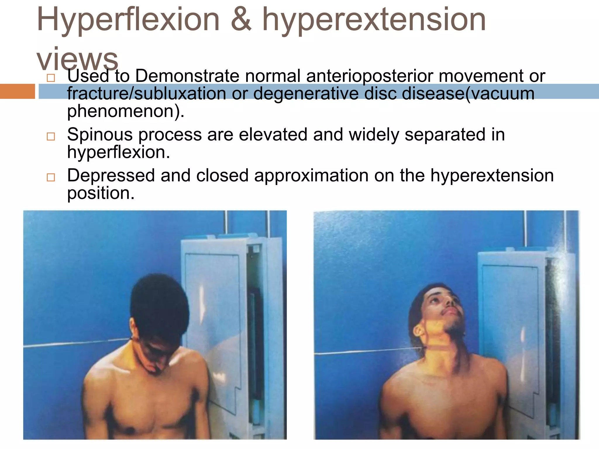 C spine positioning | PPTX