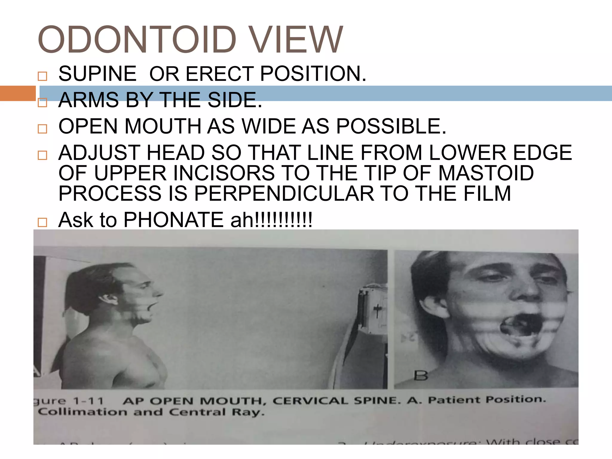 C spine positioning | PPTX