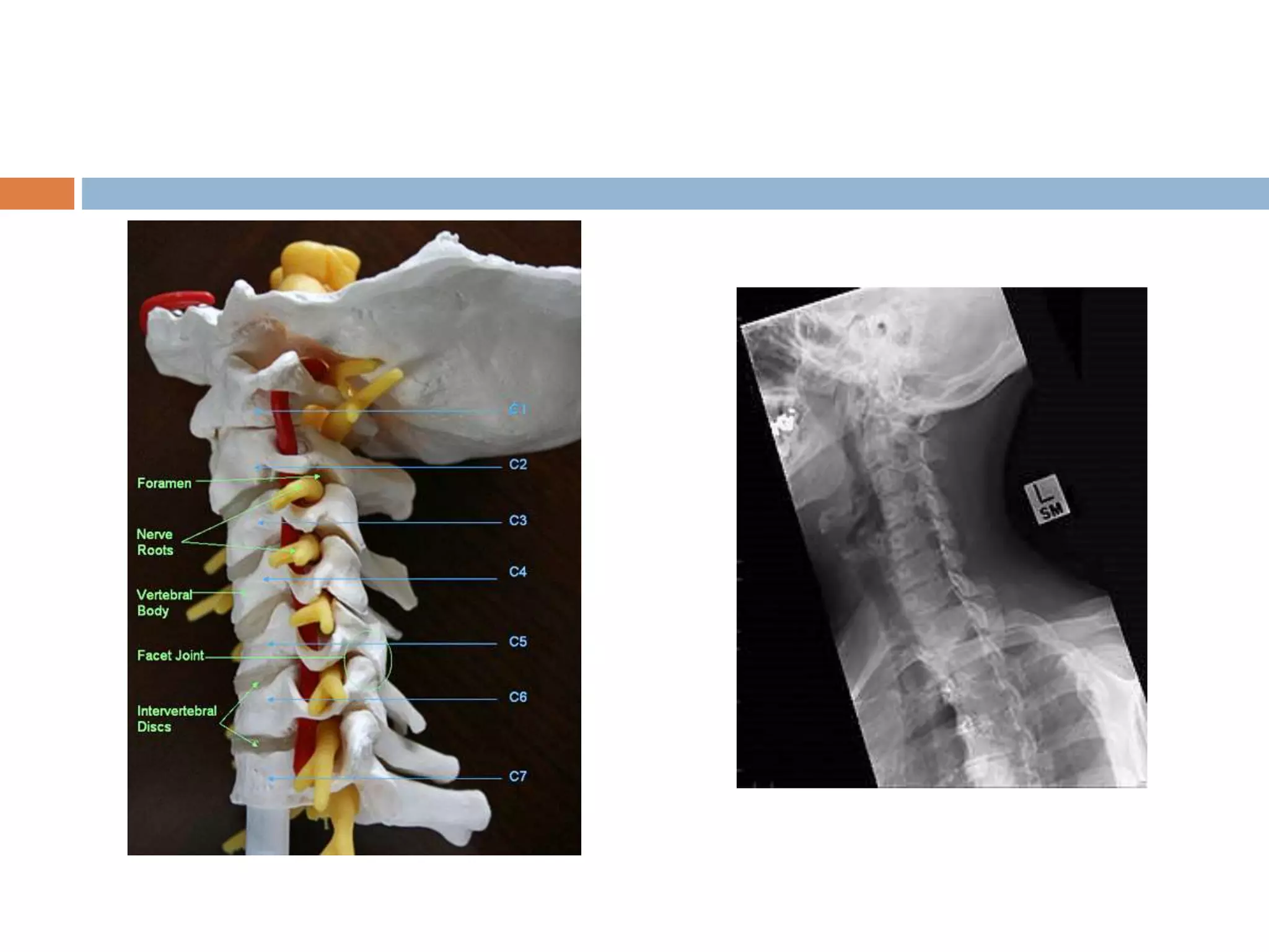 C spine positioning | PPTX