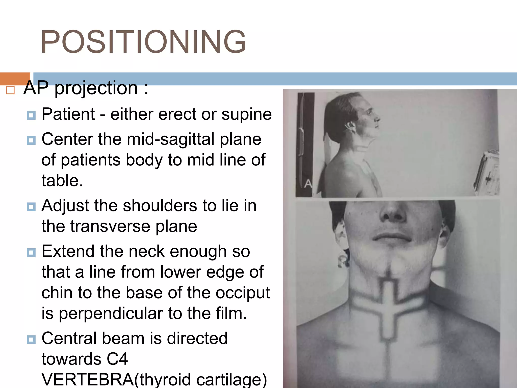 C spine positioning | PPTX