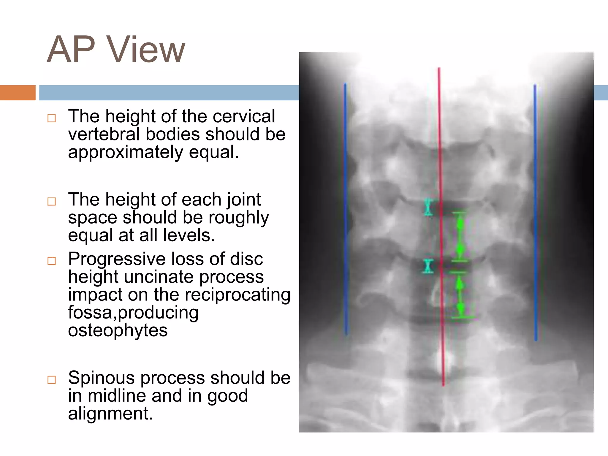 C spine positioning | PPTX