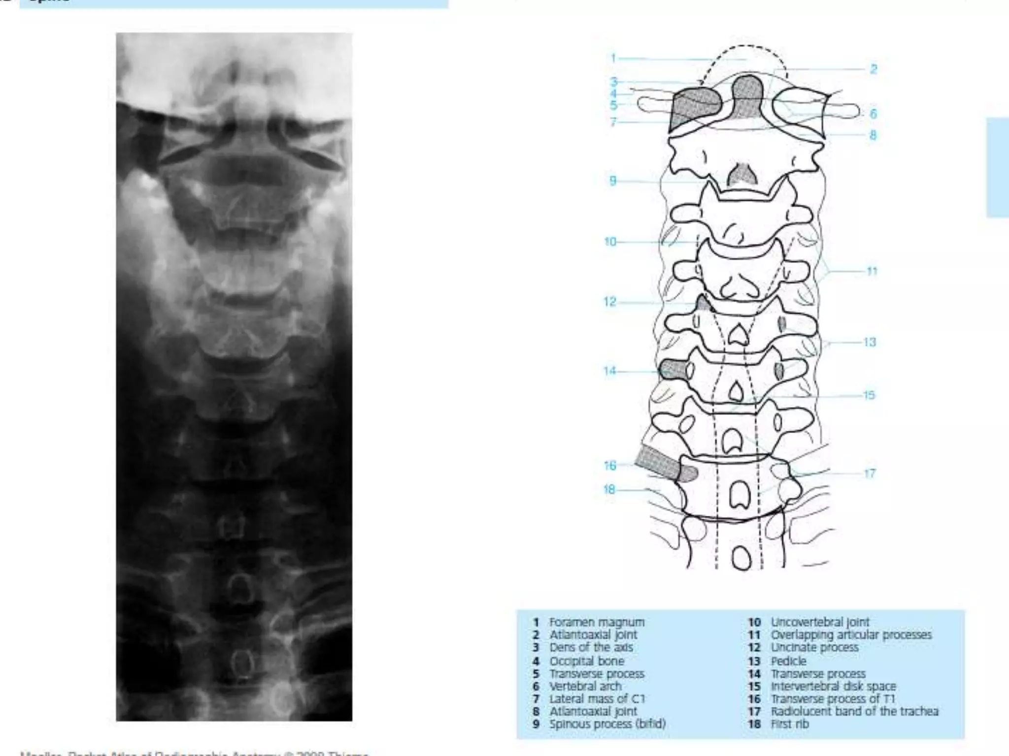 C spine positioning | PPTX