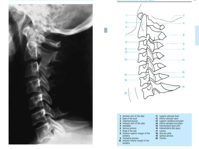 C spine positioning | PPTX