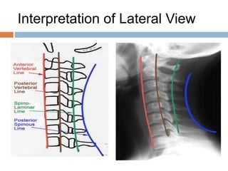 C spine positioning | PPTX