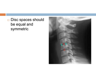 C spine positioning | PPTX