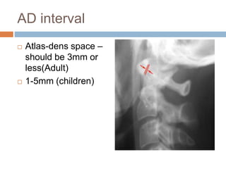 C spine positioning | PPTX