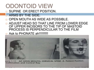 C spine positioning | PPTX