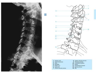 C spine positioning | PPTX