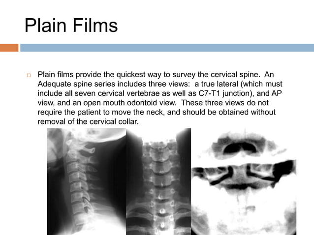 C spine positioning | PPTX