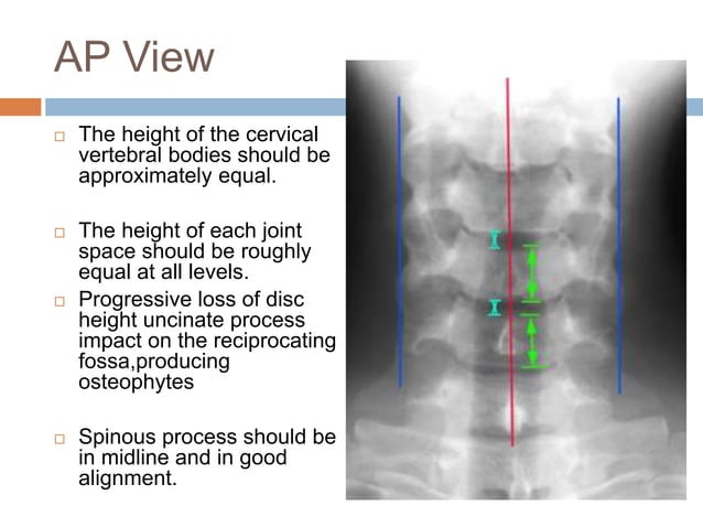 C spine positioning | PPTX