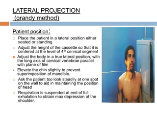C spine positioning | PPTX