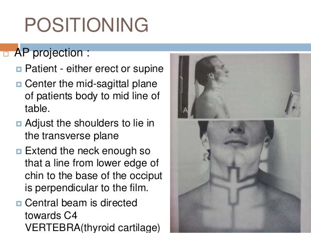 Cervical spine x ray positioning - unitmens