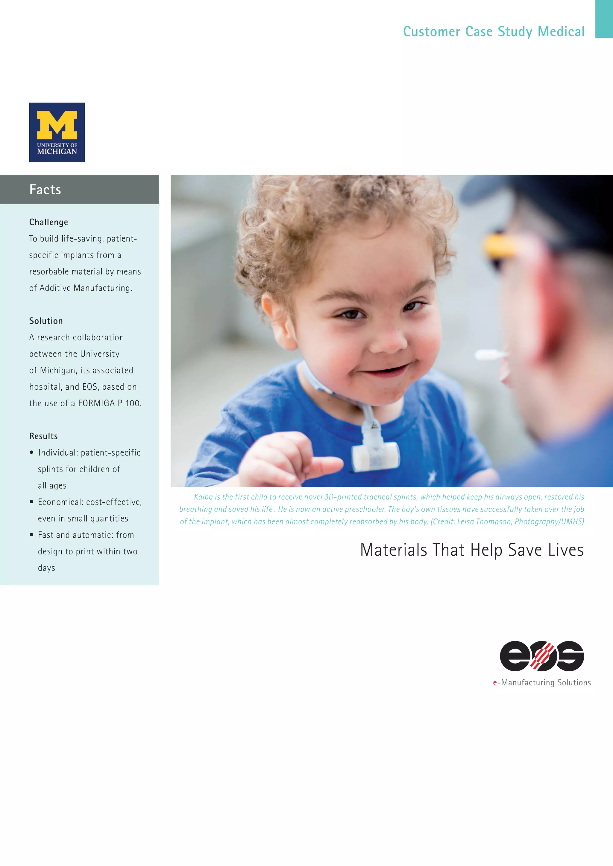 University of Michigan live-saving tracheal splints using the EOS ...