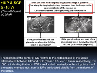 Update on Treatment of Cesarean Scar Pregnancy | PDF