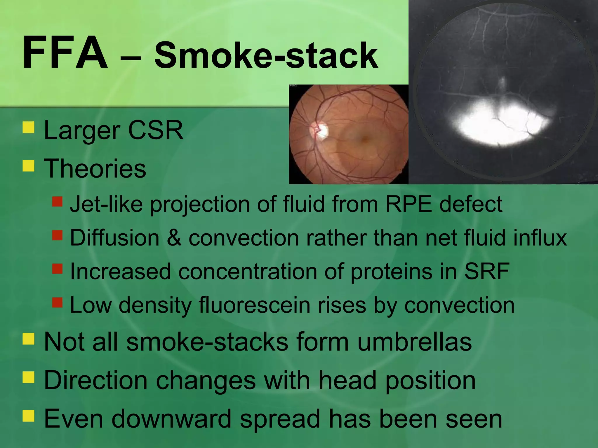 Central Serous Retinopathy | PPT