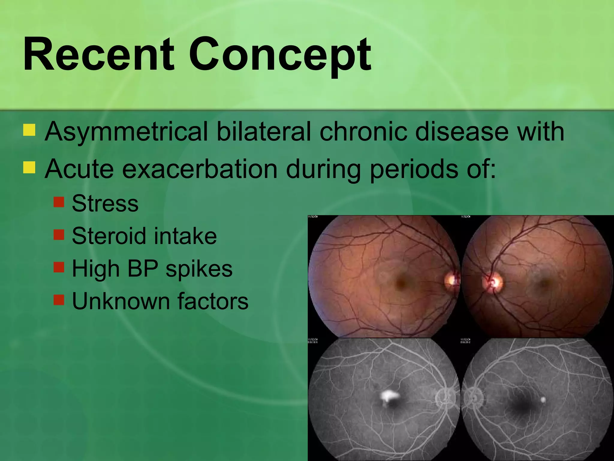 Central Serous Retinopathy | PPT
