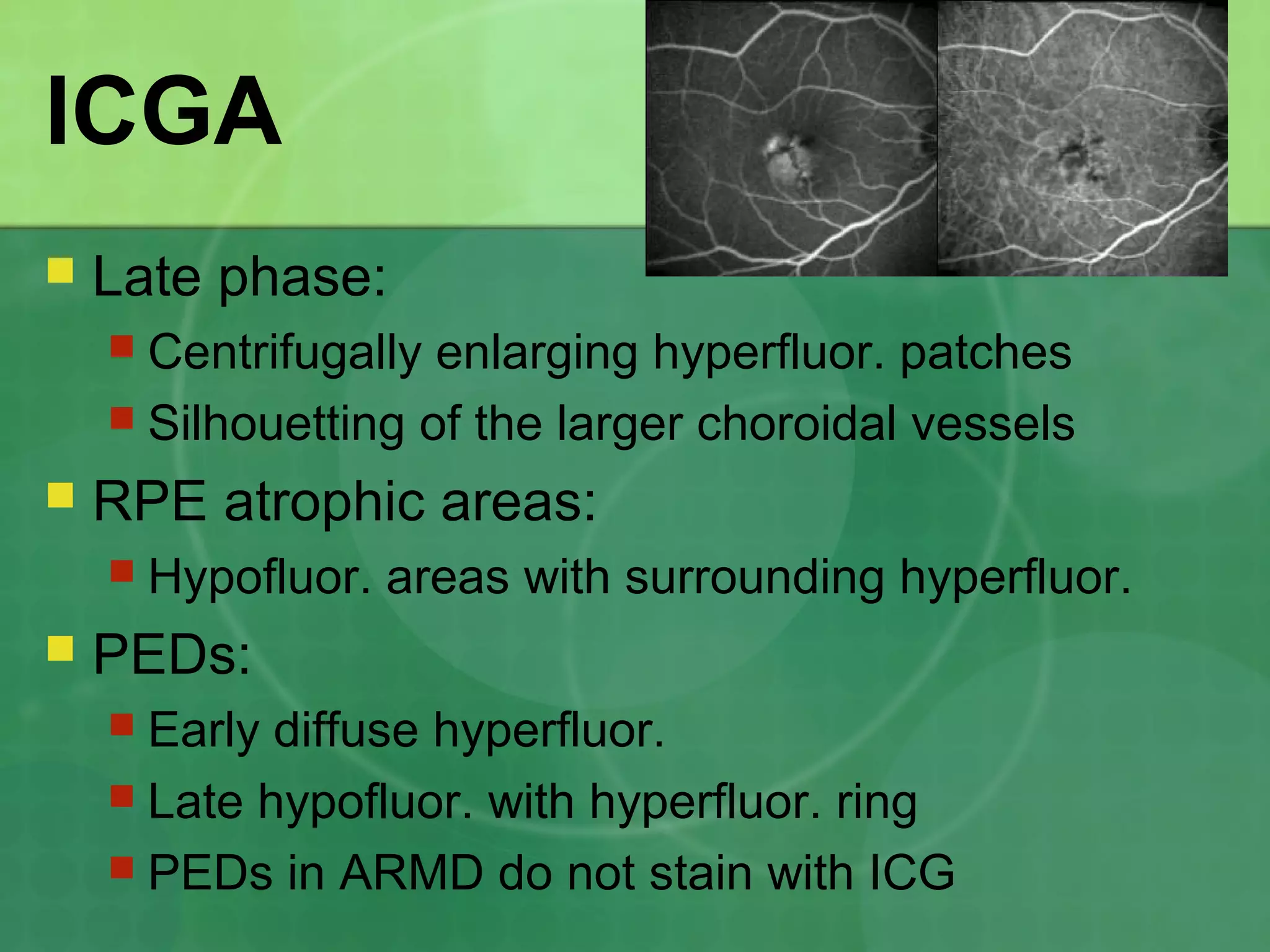 Central Serous Retinopathy | PPT