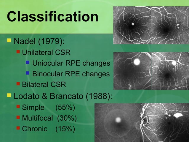 Central Serous Retinopathy | PPT