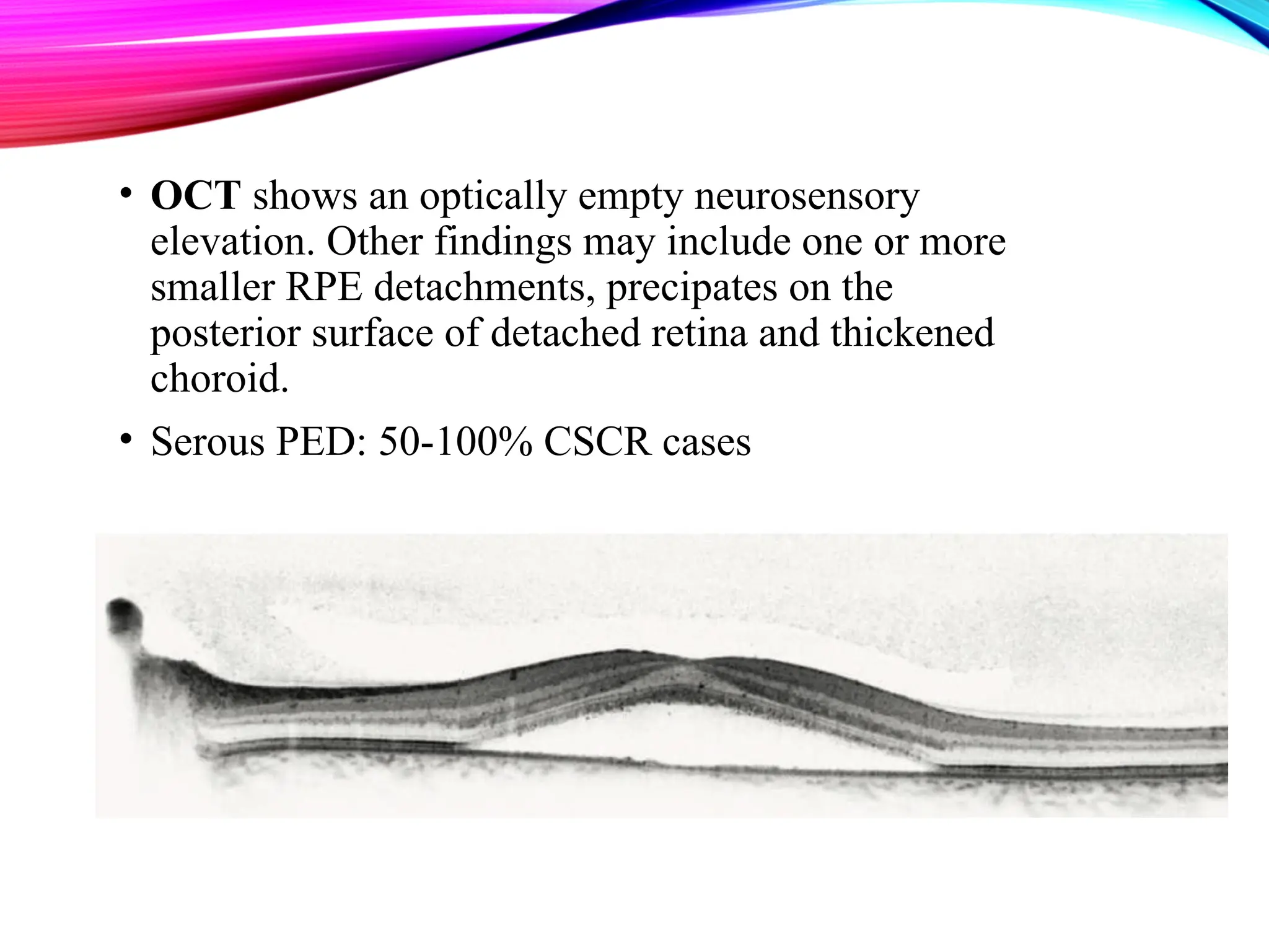 CSR central serous chorioretinopathy car | PPT