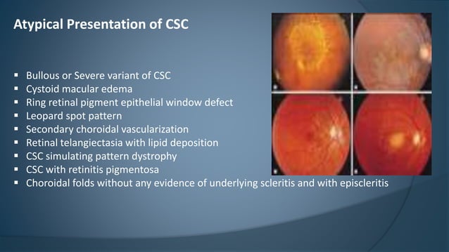Central Serous Retinopathy | PPTX | Eye and Vision Conditions ...