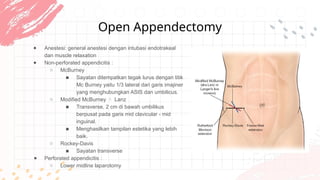Clinical Science Session Appendicitis.pptx