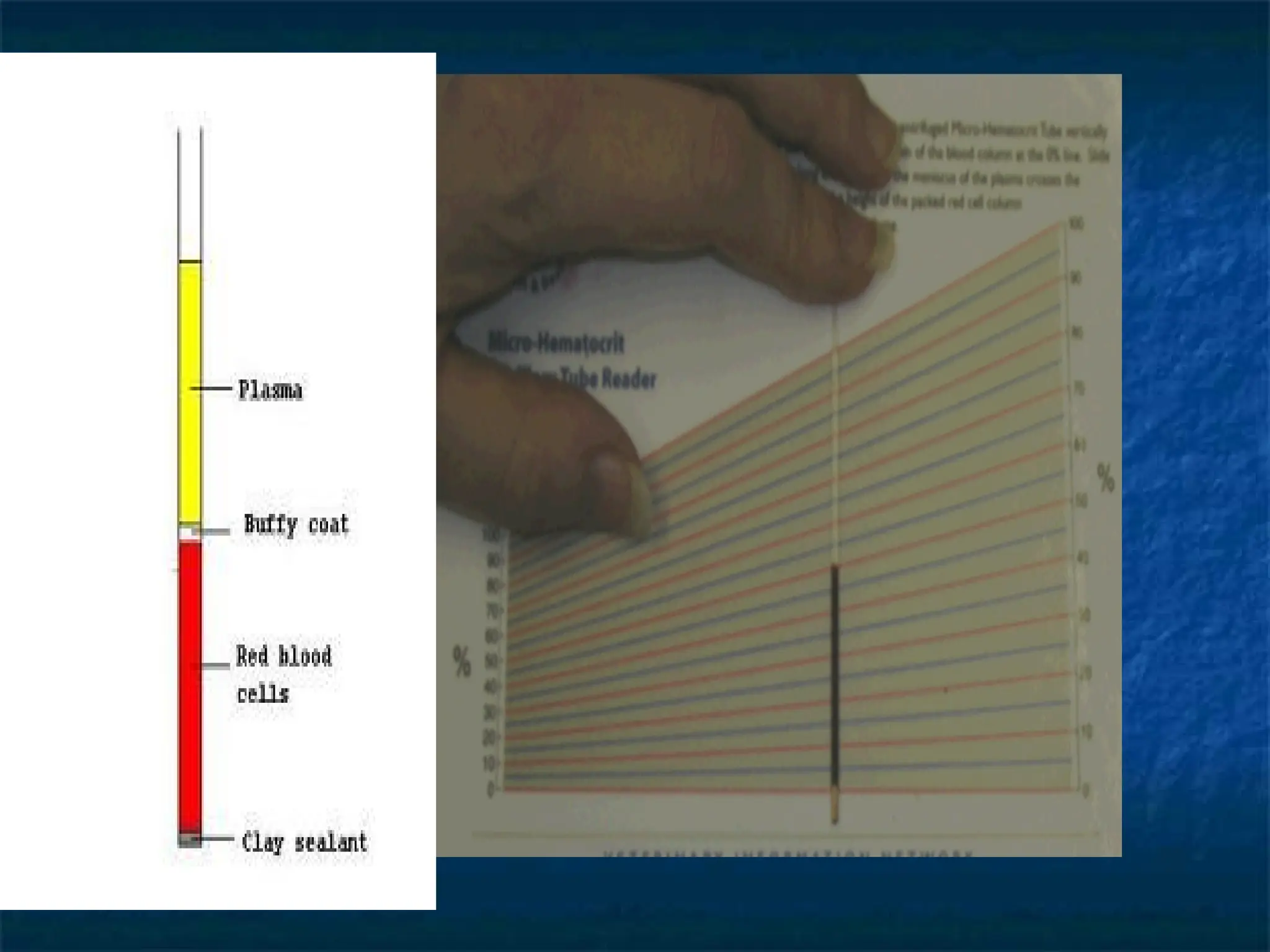 CSSD-HB PCV ESR-new.ppt HEMATOLOGY hematology | PPT