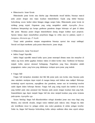 CSS Rhinosinusitis Jamur (Gerasimos Hasiholan) | DOCX