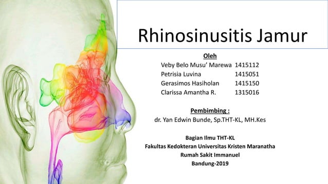 Powerpoint CSS Rhinosinusitis Jamur (Gerasimos Hasiholan) | PPT