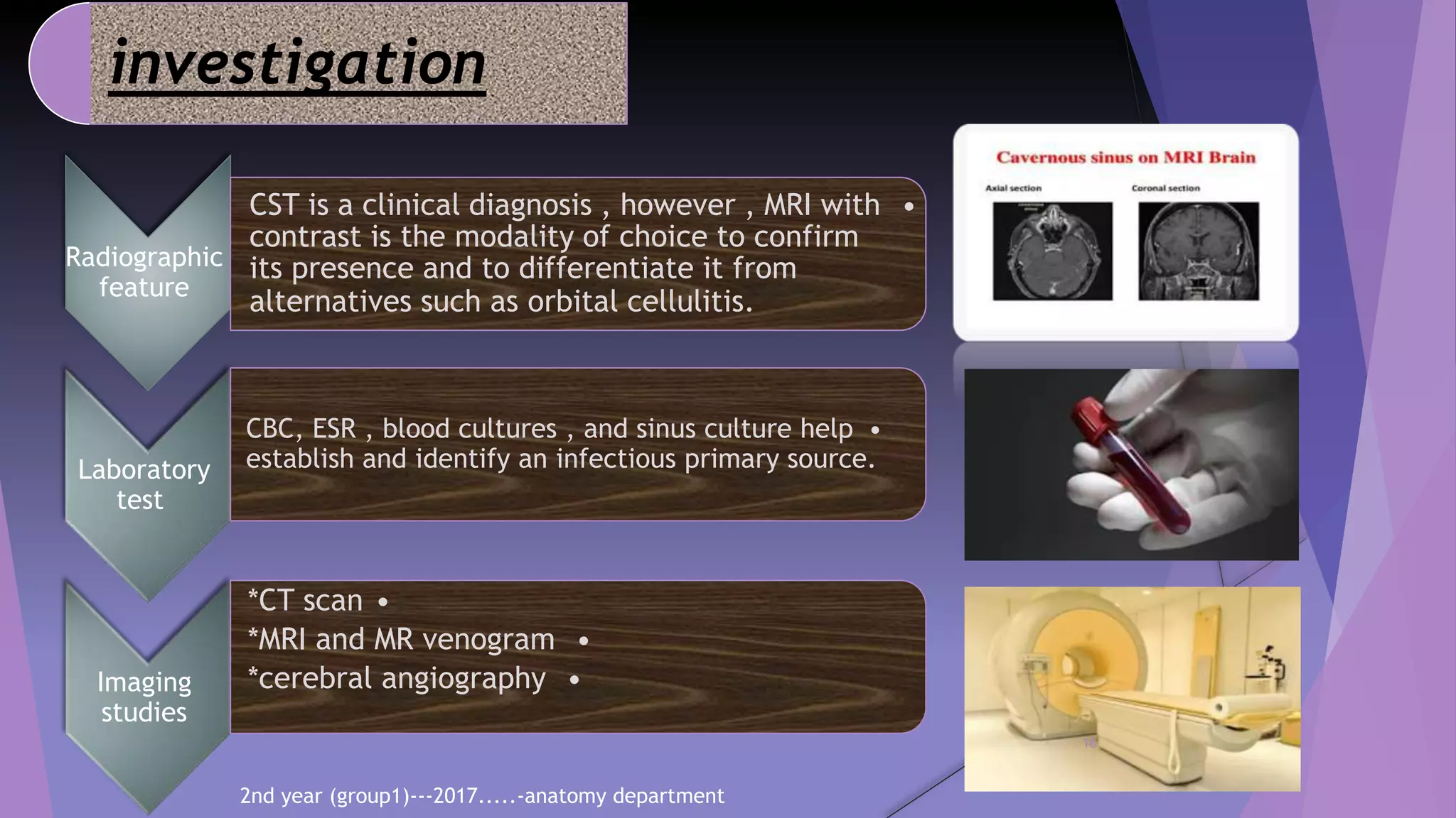 cavernous sinus thrombosis | PPSX