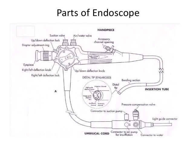 Endoscopy 120802194239-phpapp01