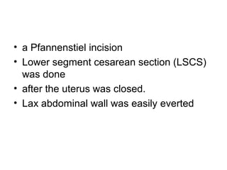 Cswithumbilicalhernia | PPT