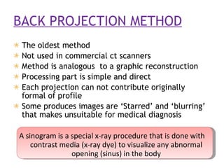 CT Scan Image reconstruction | PPT