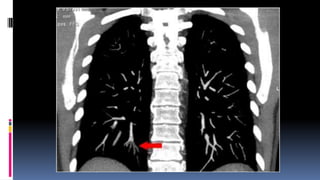 CT enhancement protocols | PPTX