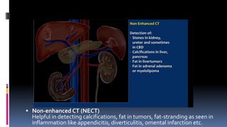 CT enhancement protocols | PPTX