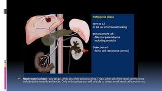 CT enhancement protocols | PPTX
