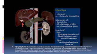 CT enhancement protocols | PPTX